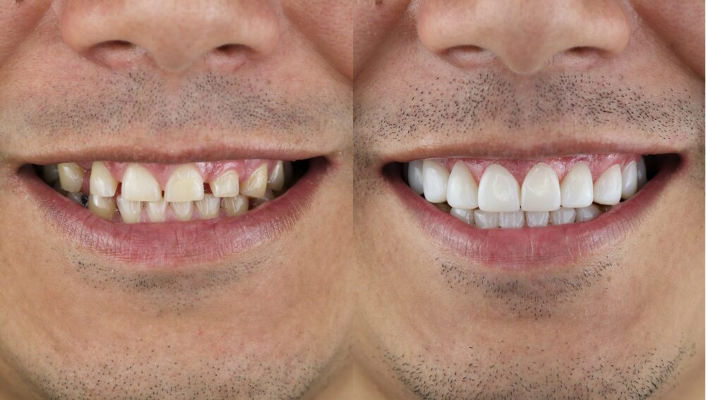 Transform Your Smile With The Right Dentist: The Art of Smile Makeovers ...